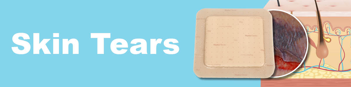 Skin Tears | Vital Medical Supplies